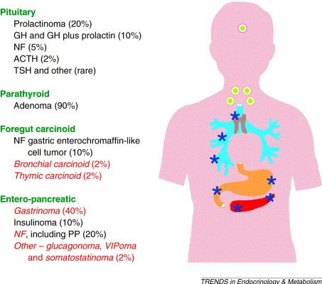 Multiple Endocrine Neoplasias - Endocrine - Orthobullets