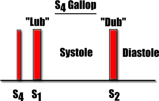 Heart Murmurs - Cardiovascular - Medbullets Step 1