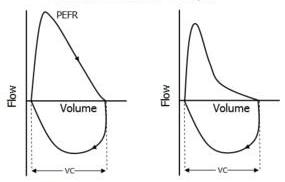 Question 100848 - Qbank - Medbullets Step 1