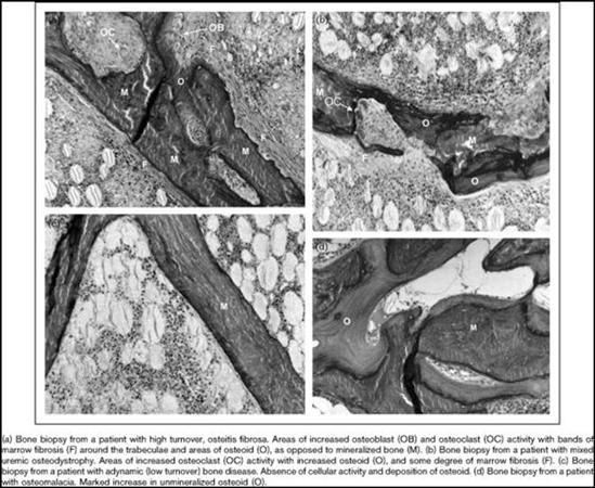 Question 101010 - Qbank - Medbullets Step 1