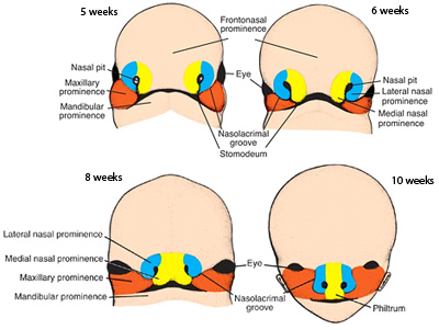 Cleft Lip and Palate - Embryology - Medbullets Step 1