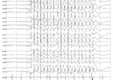 Question 103436 - Qbank - Medbullets Step 2/3
