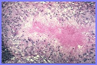 Question 103965 - Qbank - Medbullets Step 2/3