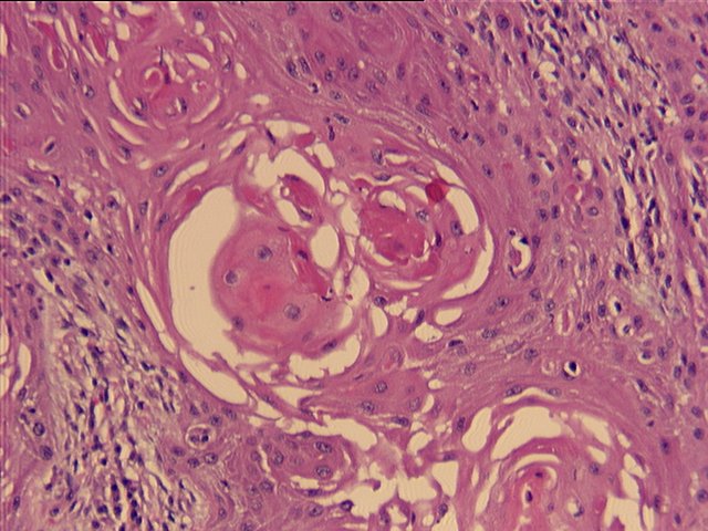 Question 104262 - Qbank - Medbullets Step 1