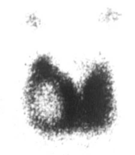 Question 104667 - Qbank - Medbullets Step 1