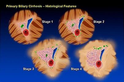 Question 104875 - Qbank - Medbullets Step 2/3