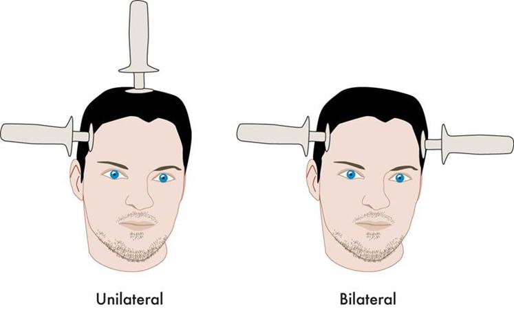 Question 105686 - Qbank - Medbullets Step 2/3