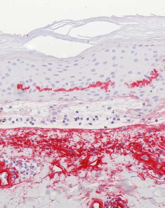 Question 106537 - Qbank - Medbullets Step 2/3