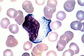 Atypical Lymphocyte Ebv