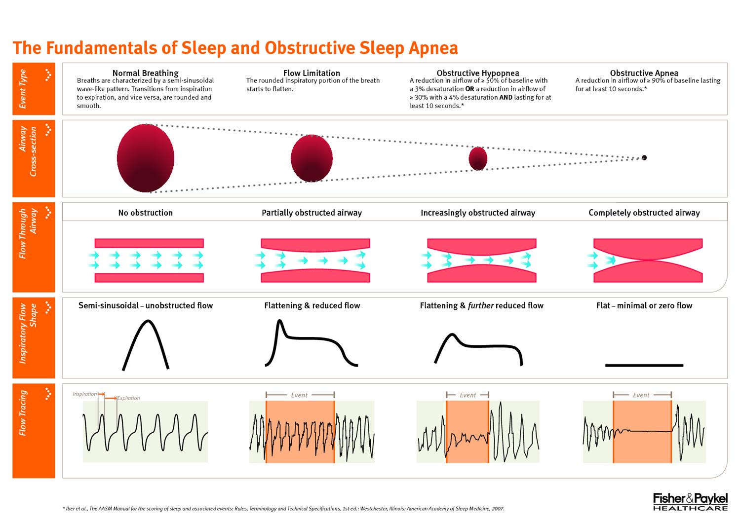 Sleep Apnea - Respiratory - Medbullets Step 1