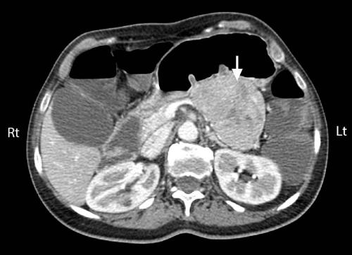 Question 107118 - Qbank - Medbullets Step 1