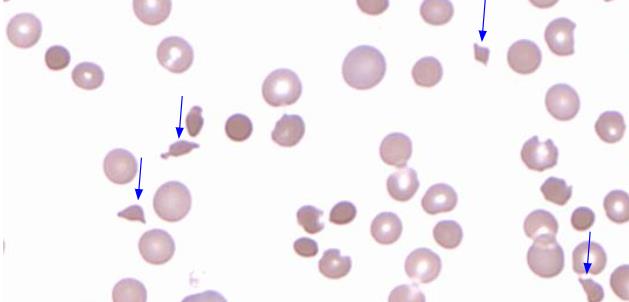 Question 107183 - Qbank - Medbullets Step 2/3