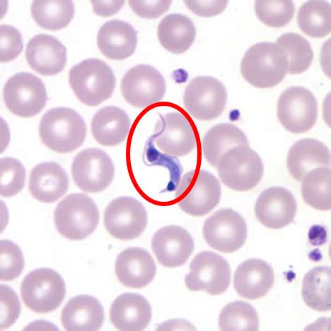 Question 108604 - Qbank - Medbullets Step 2/3