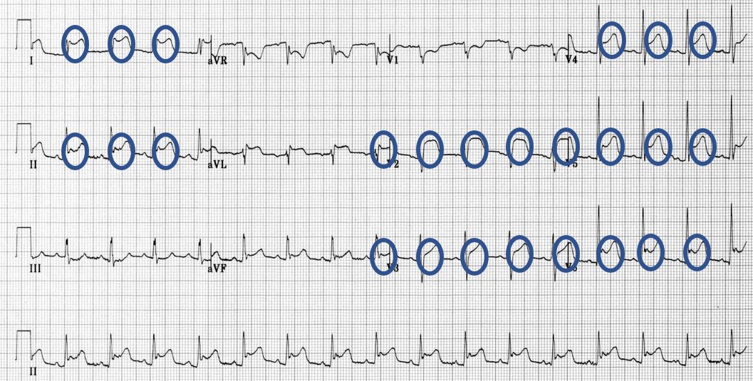 Question 108974 - Qbank - Medbullets Step 2/3
