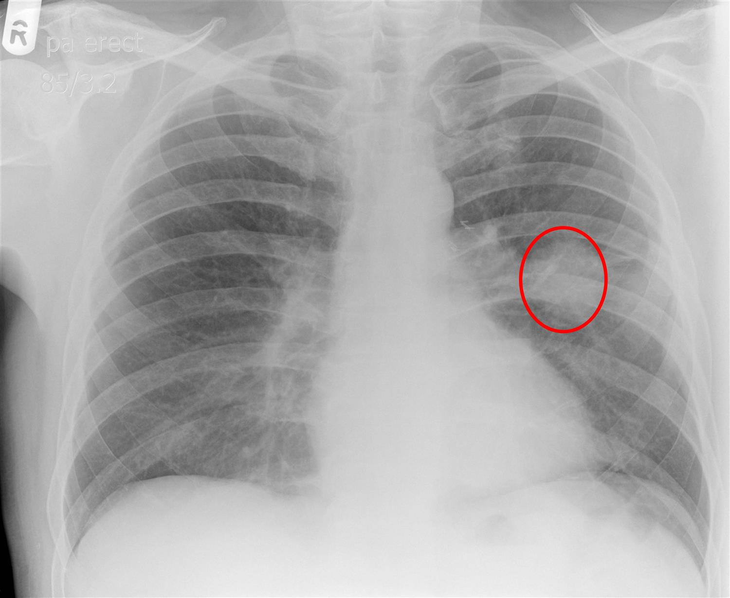 Question 109965 - Qbank - Medbullets Step 2/3