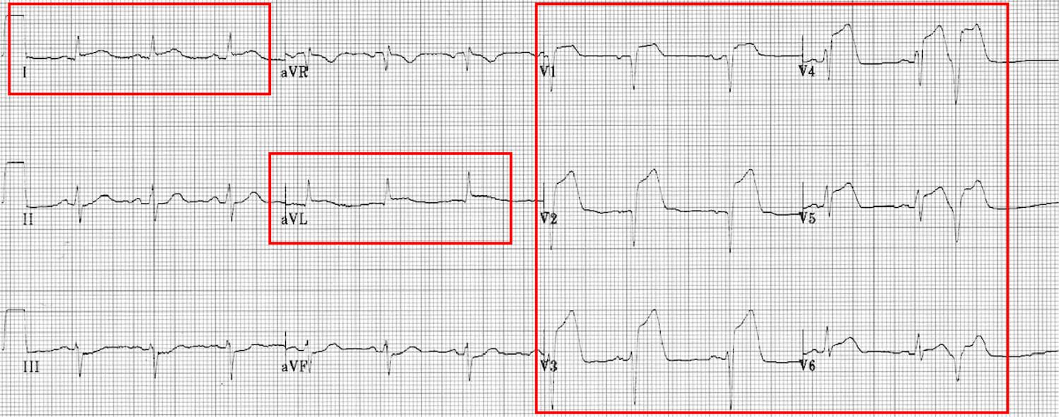 Question 214534 - Qbank - Medbullets Step 2/3