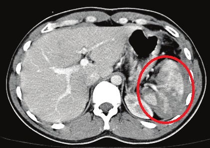 Question 215049 - Qbank - Medbullets Step 2/3