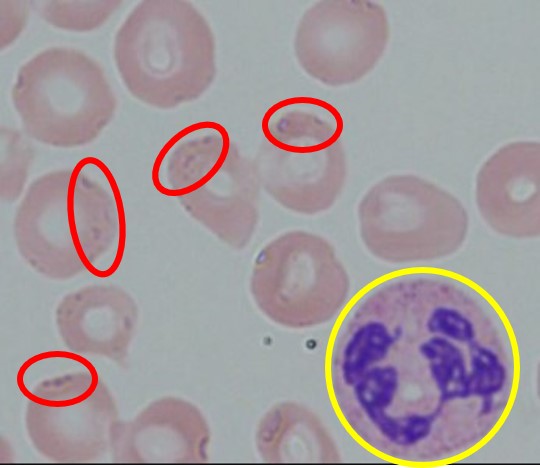 Question 216476 - Qbank - Medbullets Step 2/3