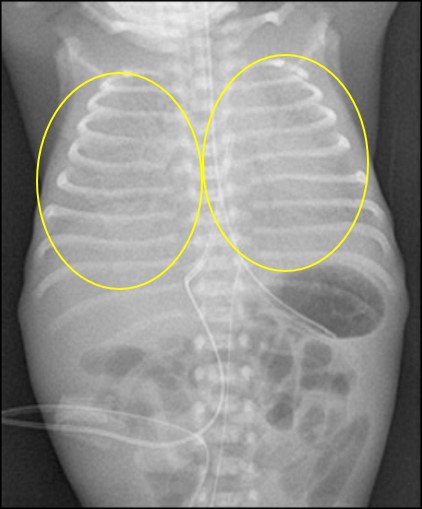 Question 216481 - Qbank - Medbullets Step 1