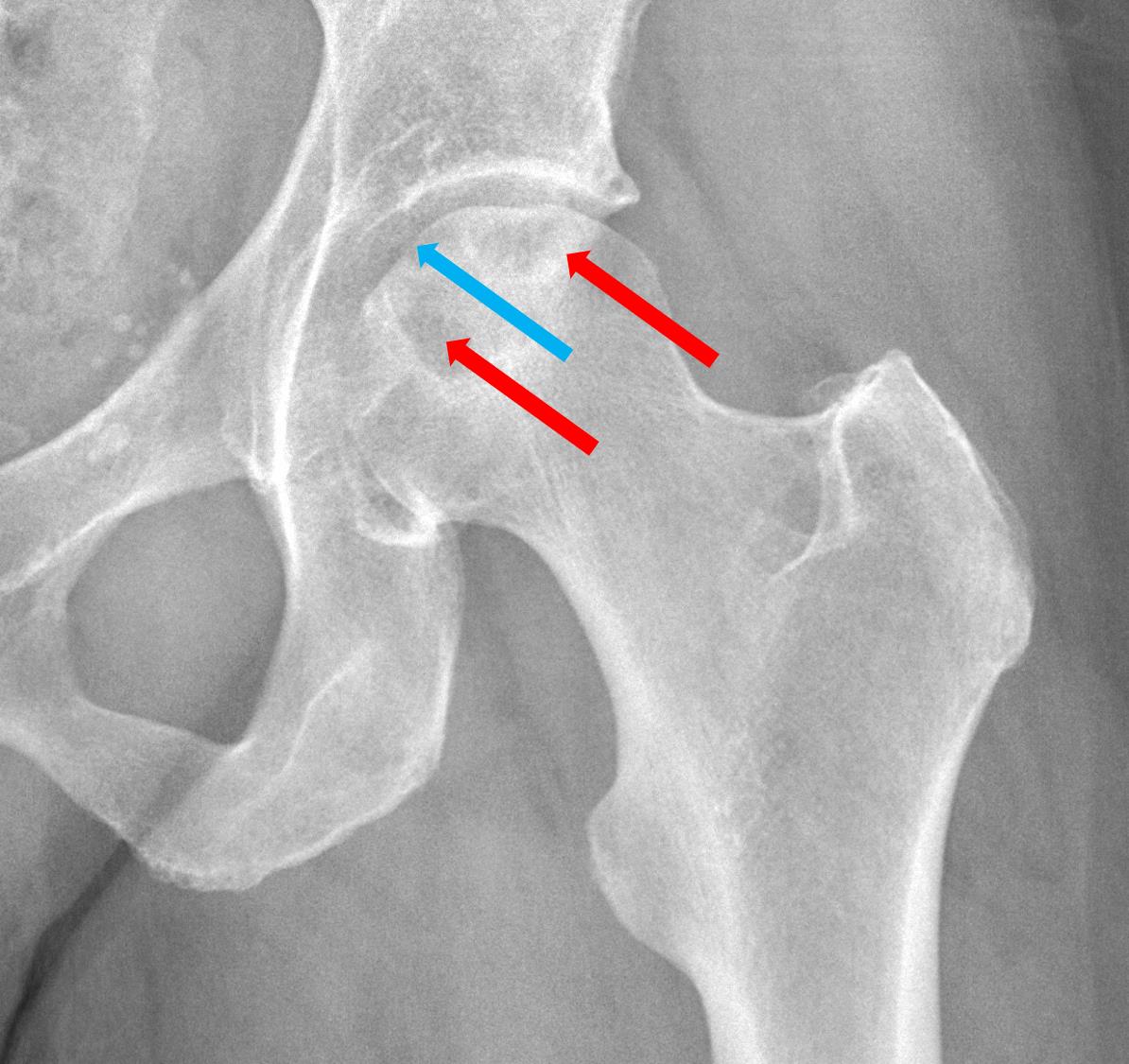 Question 216499 - Qbank - Medbullets Step 2/3