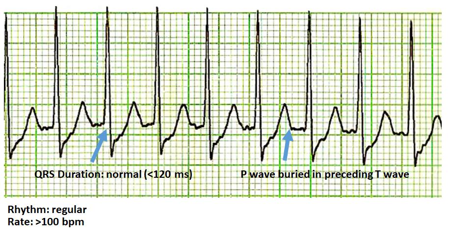 Question 216548 - Qbank - Medbullets Step 1