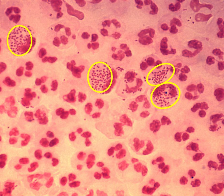 Question 217295 - Qbank - Medbullets Step 1