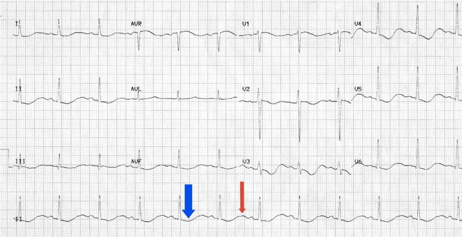Question 217306 - Qbank - Medbullets Step 2/3