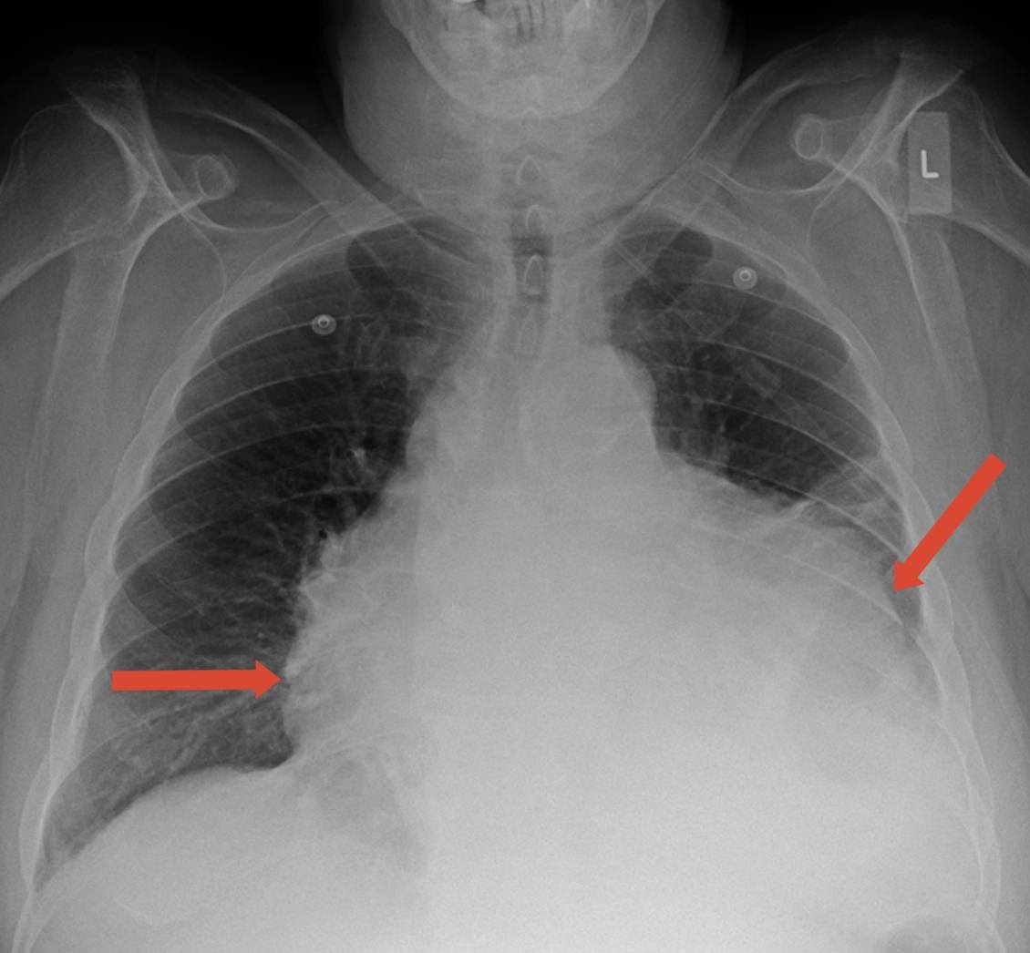 Question 217309 - Qbank - Medbullets Step 2/3
