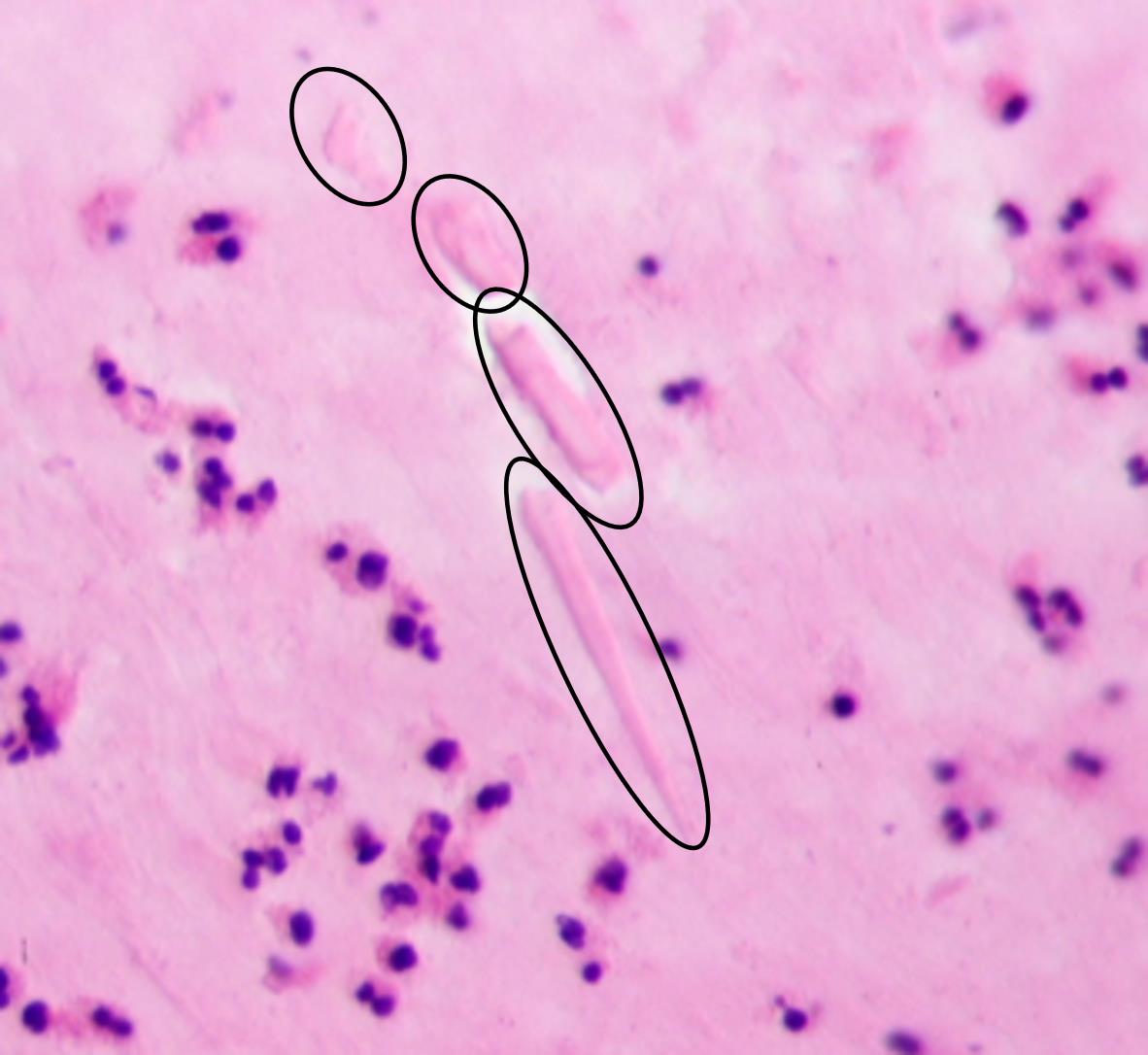 Question 217699 - Qbank - Medbullets Step 1