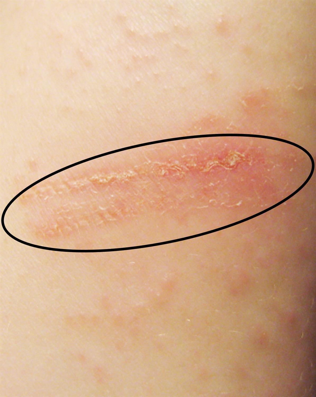 Question 218522 - Qbank - Medbullets Step 1