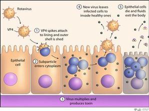 Rotavirus - Microbiology - Medbullets Step 1