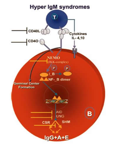 Hyper IgM Syndrome - Immunology - Medbullets Step 1
