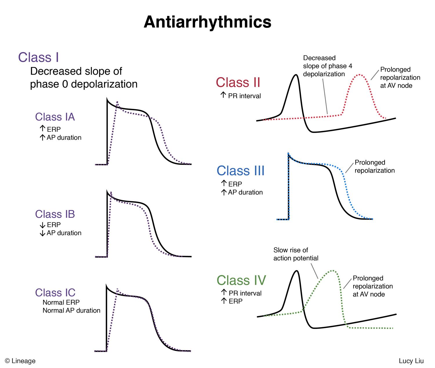 Antiarrhythmics USMLE Strike