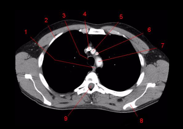Lung Relationships - Respiratory - Medbullets Step 1